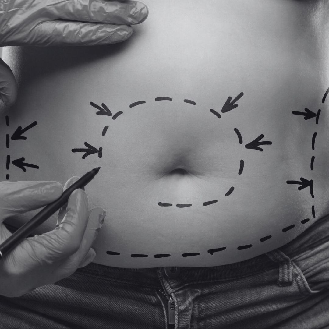 BODY LIFT-HOMME - mclinicmorocco